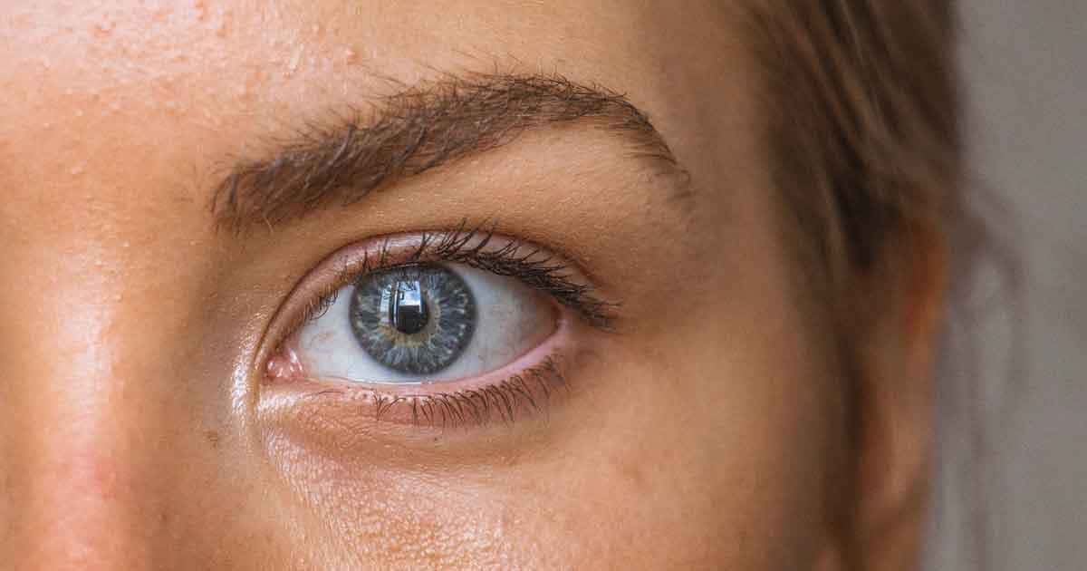 Sun Spots on Your Skin: 3 Things You Need to Do - NonCount.com